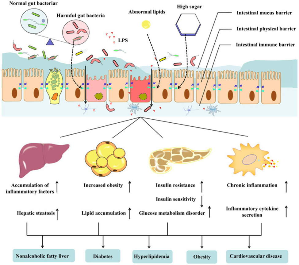 Diet Influences Intestinal Permeability and Leaky Gut