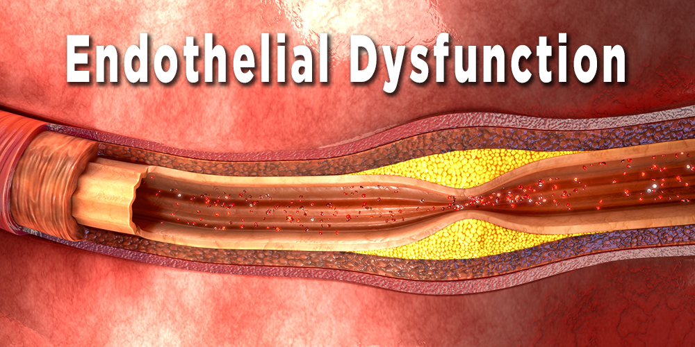 Supplements for Endothelial Dysfunction: Naturopathic Approach ...