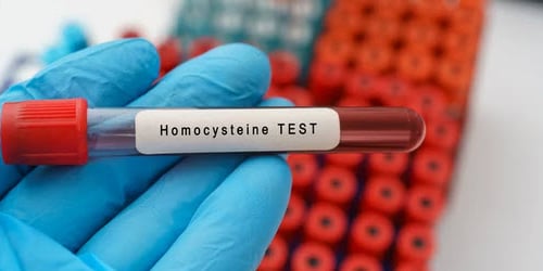 Homocysteine: Highs, Lows, and Optimals